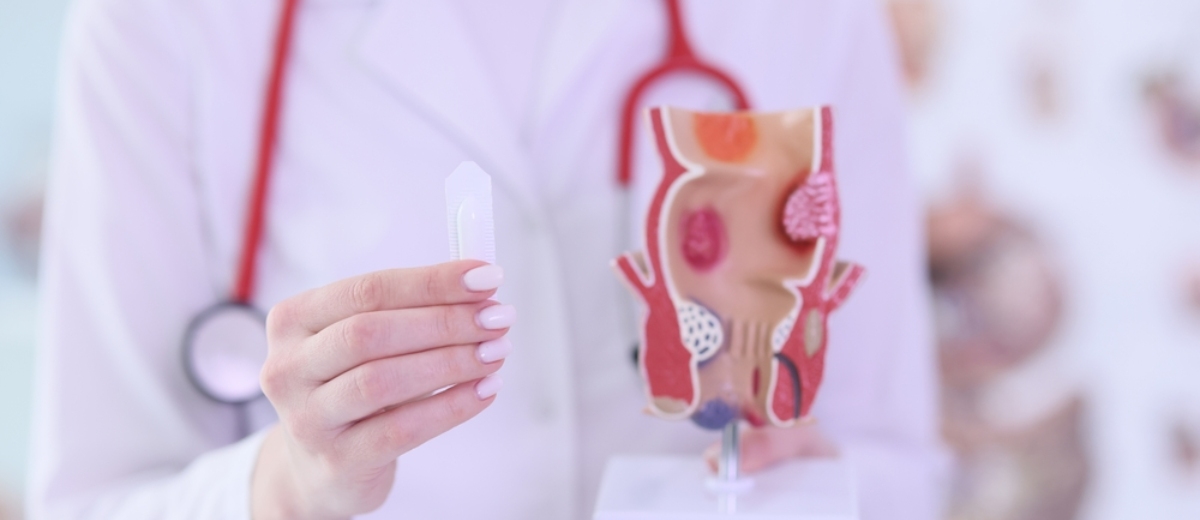 Emorroidi: cosa sono e come curarle - Santagostino Genova